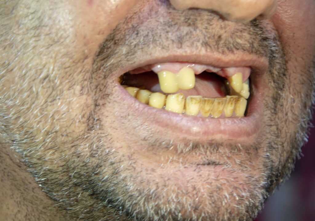 Don't Smoke? Living Or Working With A Smoker Creates Higher Risks Than ...