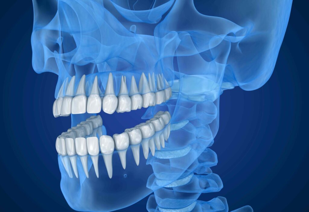 Six Reasons To Have Your Dental Implants Placed By A Periodontist ...