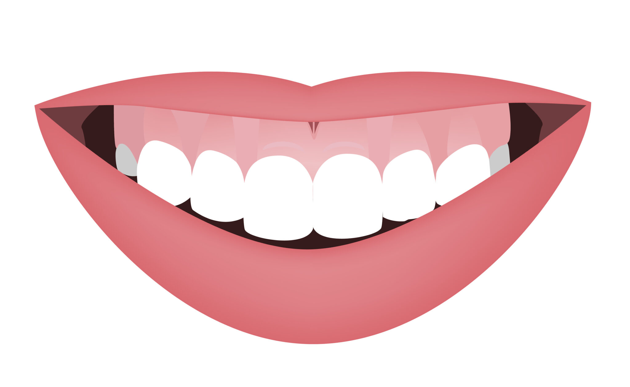 Choose A Periodontist To Correct A Gummy Smile | William J. Claiborne ...